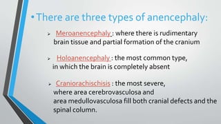 The neural tube defects | PPTX