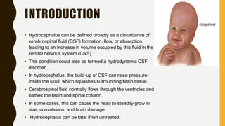 Hydrocephalus | PPT