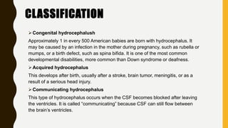 Hydrocephalus | PPT