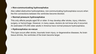 Hydrocephalus | PPT
