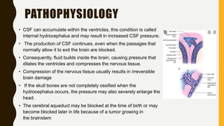 Hydrocephalus | PPTX