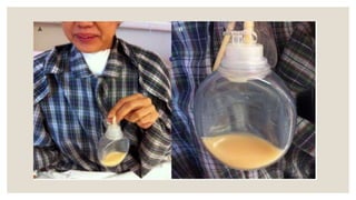 Management of Chyle leakage after head and neck surgery - DIKIOHS DUHS ...