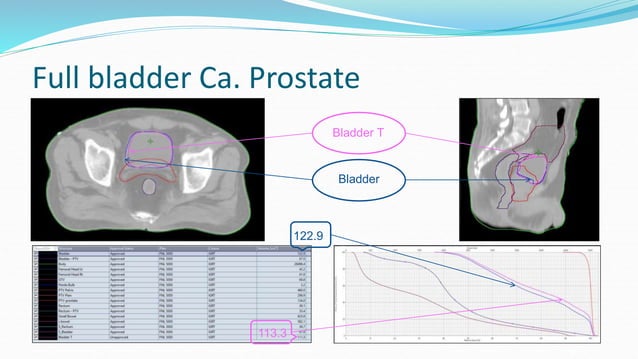 BLADDER PROTOCOL :- IS IT NECESSARY ? | PPT