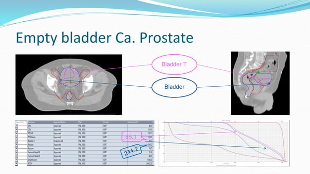 BLADDER PROTOCOL :- IS IT NECESSARY ? | PPT
