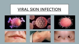 Presentation (3).pptx | Infectious Diseases | Diseases and Conditions