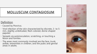 Presentation (3).pptx | Infectious Diseases | Diseases and Conditions
