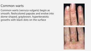 Presentation (3).pptx | Infectious Diseases | Diseases and Conditions