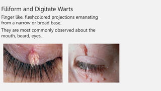 Presentation (3).pptx | Infectious Diseases | Diseases and Conditions