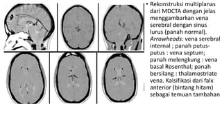 presentasi radiologi ct scan kepala 2022 | PPTX