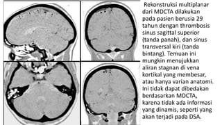 presentasi radiologi ct scan kepala 2022 | PPTX