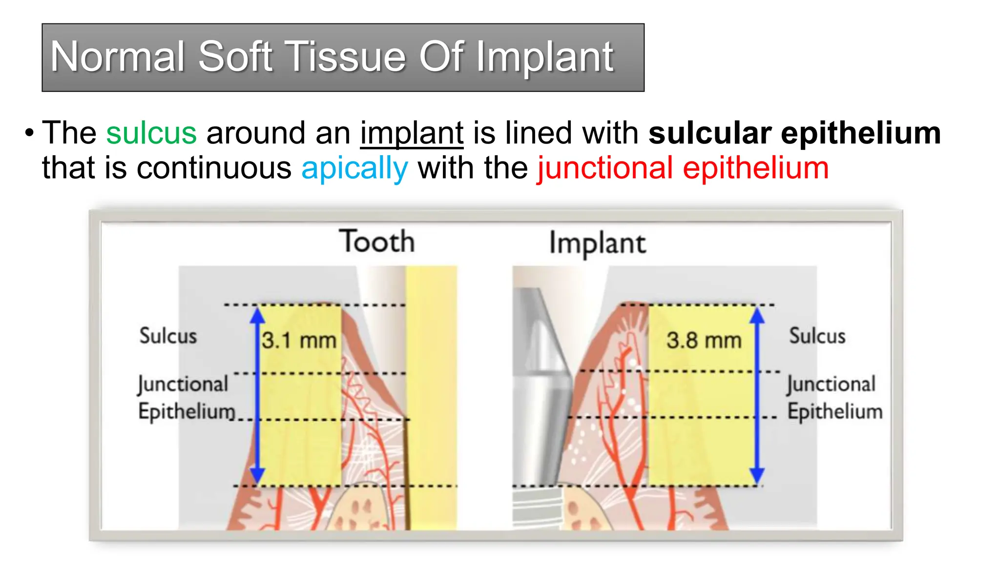 per-implant pathology (per-implanitits + Peri-Implant Mucositis) | PPTX