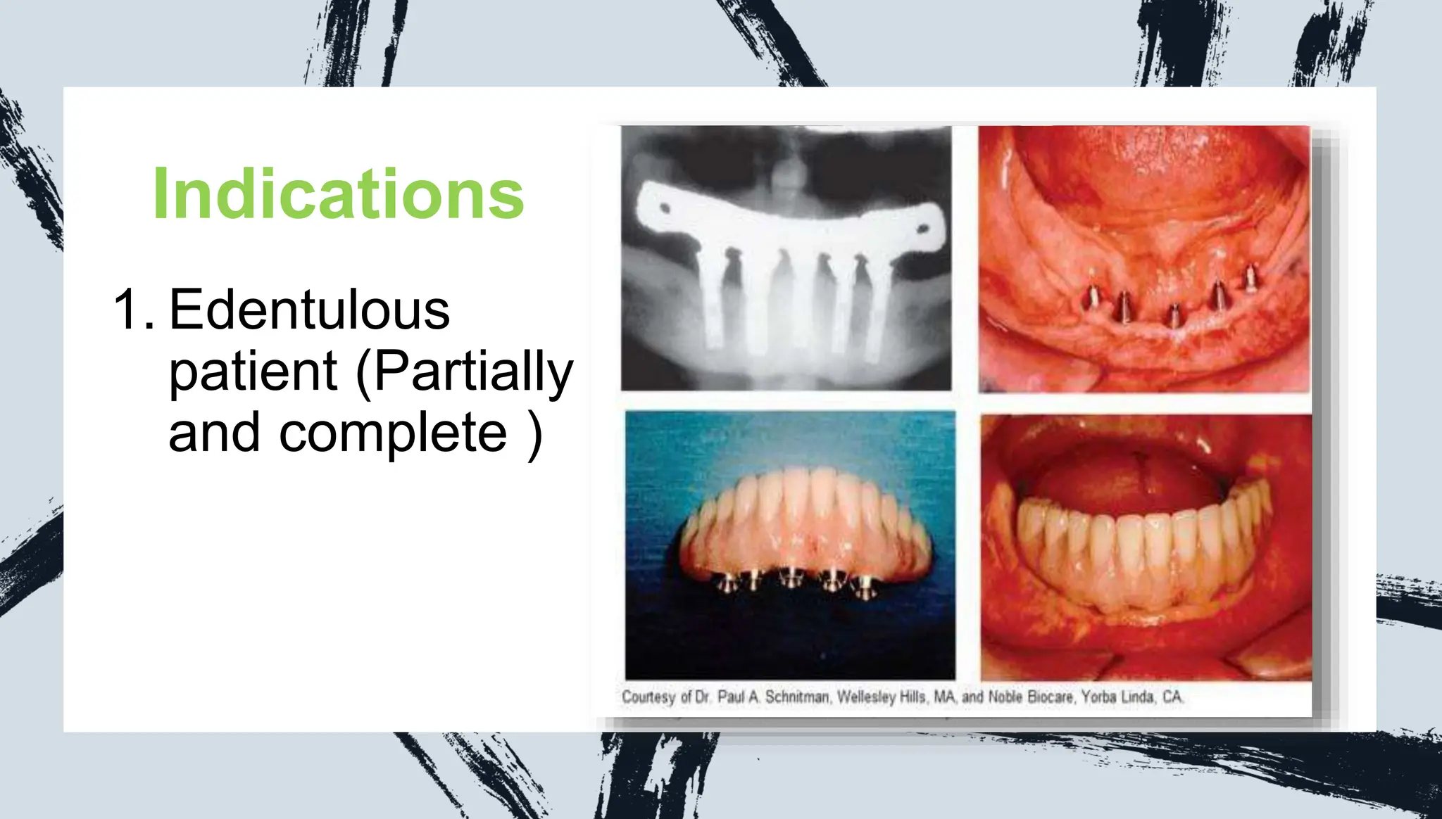 per-implant pathology (per-implanitits + Peri-Implant Mucositis) | PPTX