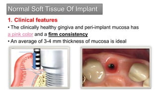 per-implant pathology (per-implanitits + Peri-Implant Mucositis) | PPTX