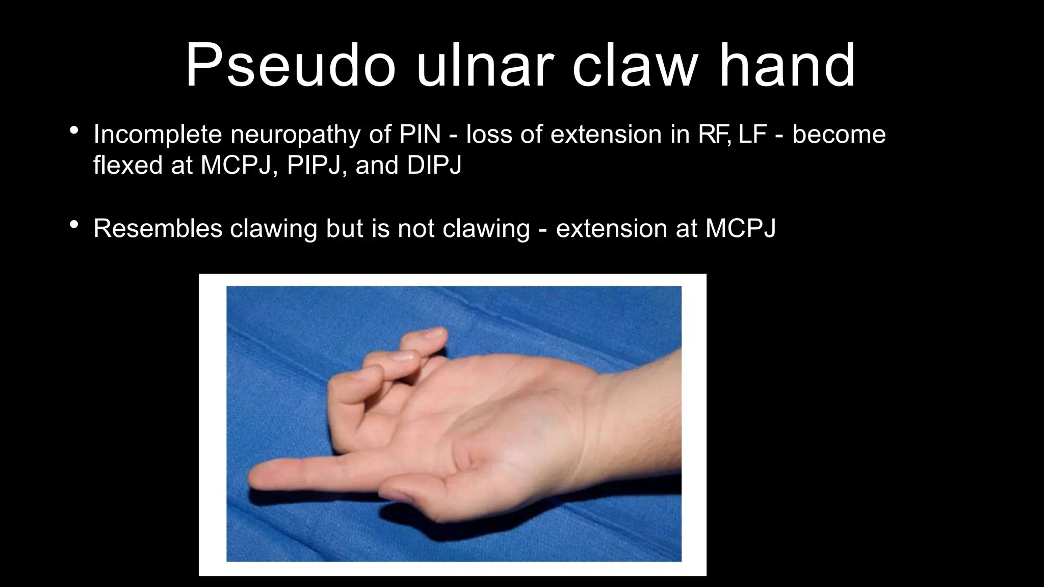 Nerve supply of upper limb detailed.pptx