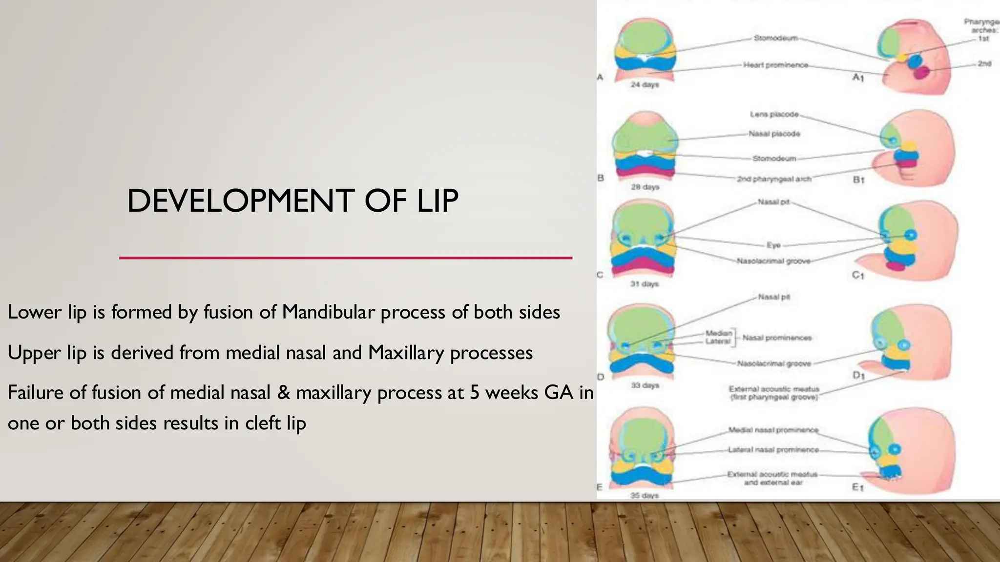 Cleft lip & palate topic. I made this topic simple and clear to you ...