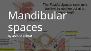 Mandibular space infections Presentation3.pptx
