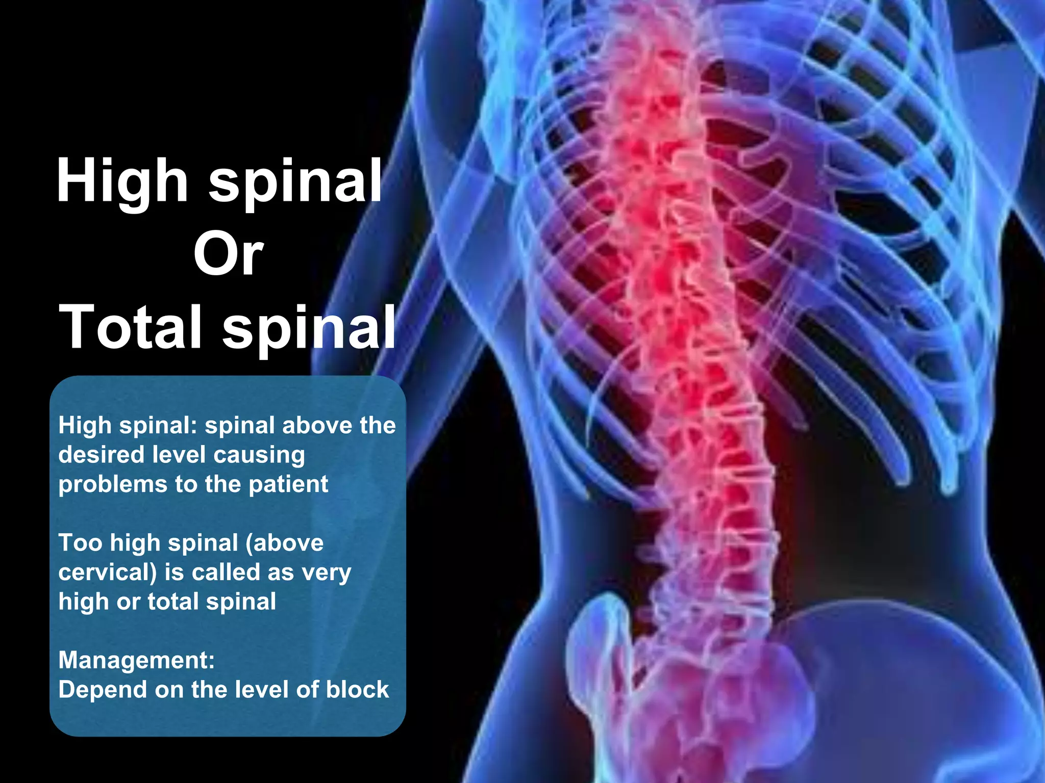 COMPLICATIONS OF SPINAL & EPIDURAL ANAESTHESIA | PPTX