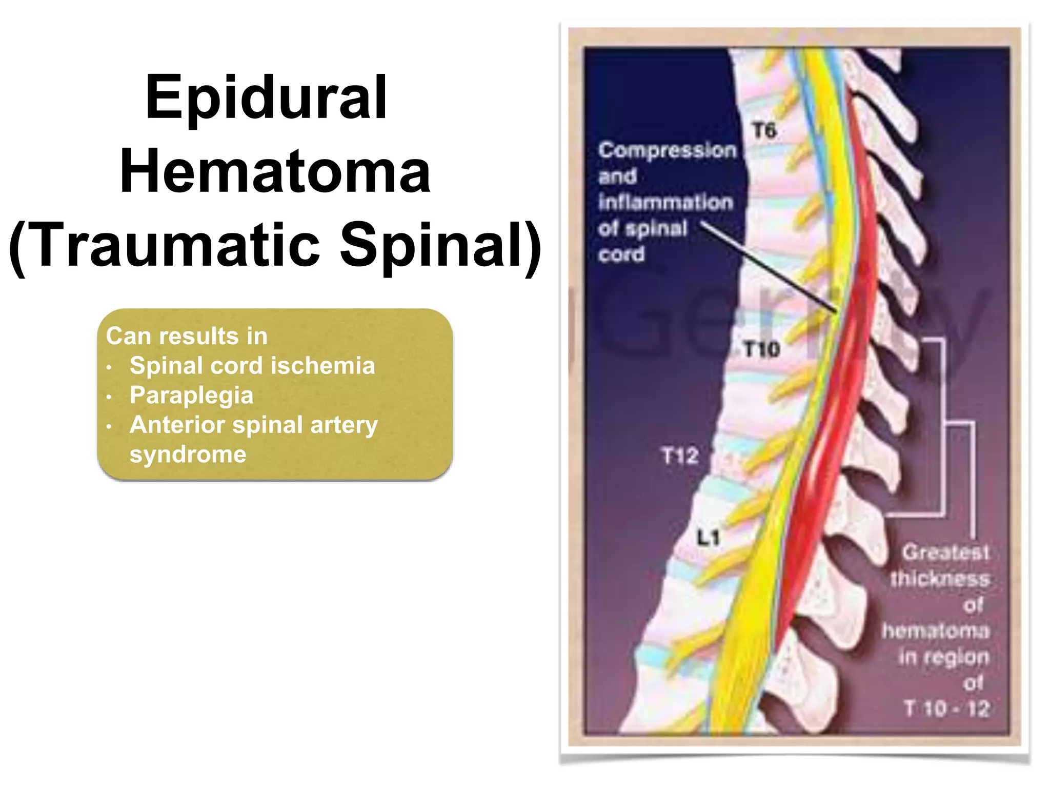 COMPLICATIONS OF SPINAL & EPIDURAL ANAESTHESIA | PPTX