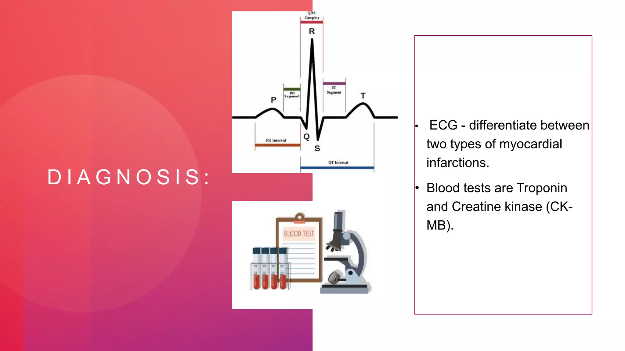 pathophysiology of myocardial infarction | PPTX