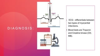 pathophysiology of myocardial infarction | PPTX