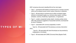 pathophysiology of myocardial infarction | PPTX