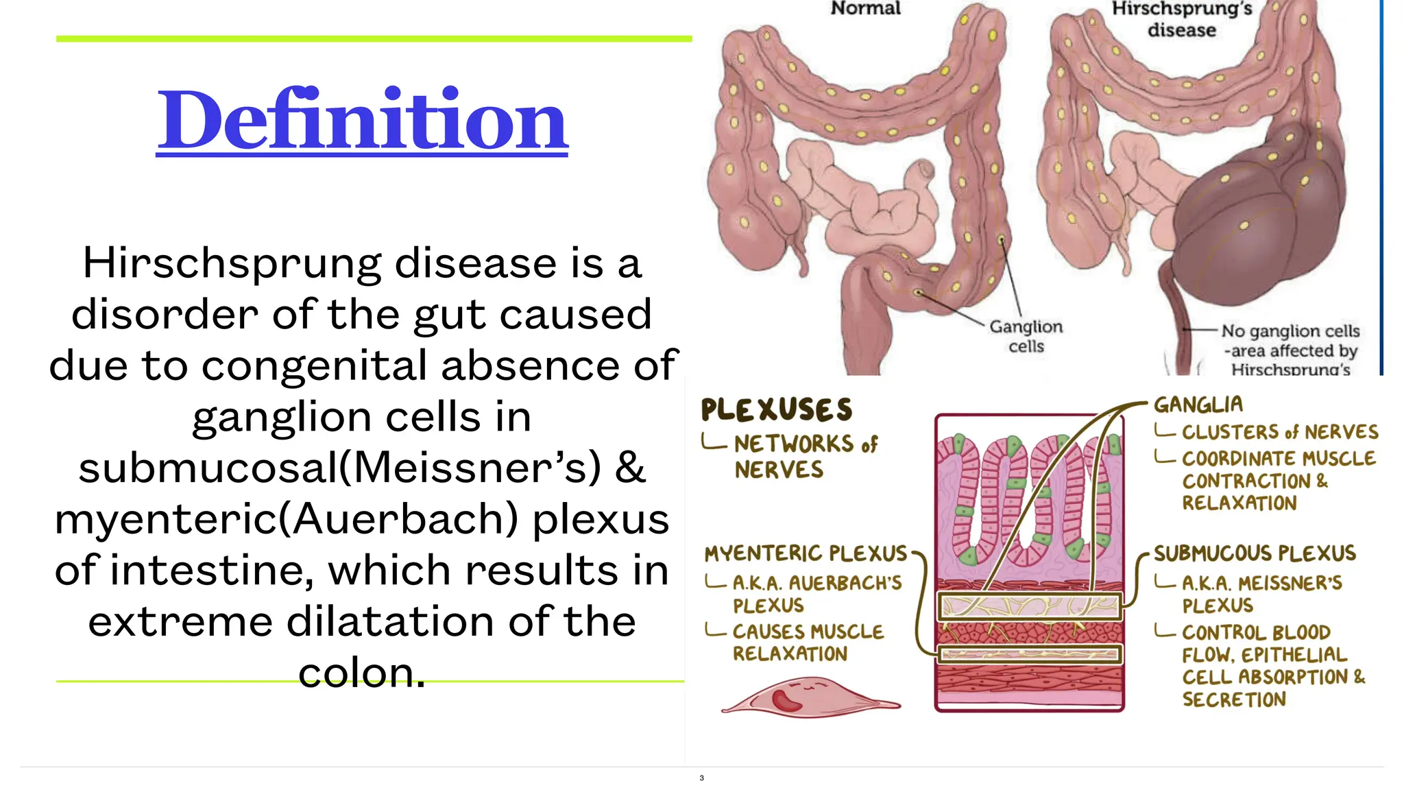 Hirschsprungʼs disease Child health nursing ppt | PDF