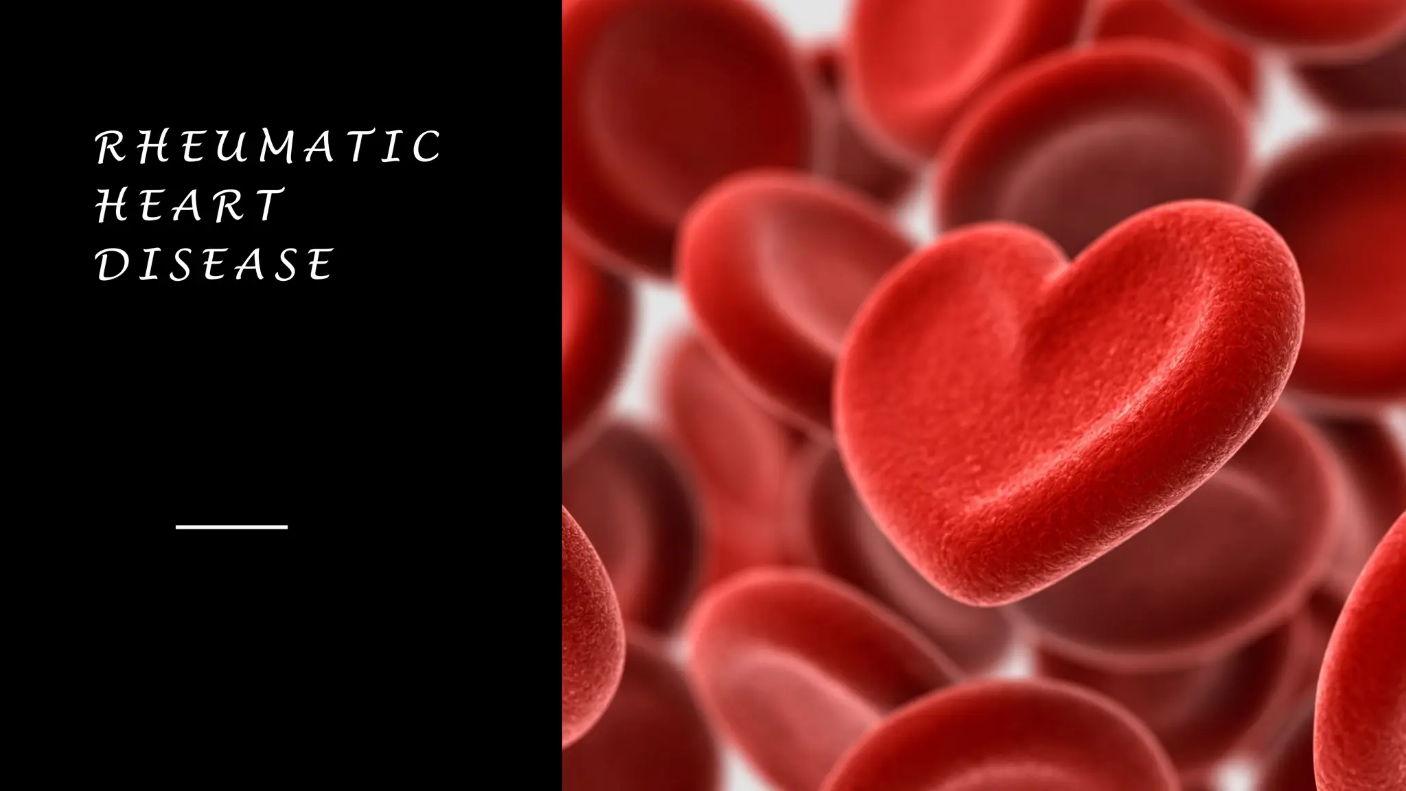 Rheumatic Heart Disease powerpoint for bio anatomy/physiology students ...