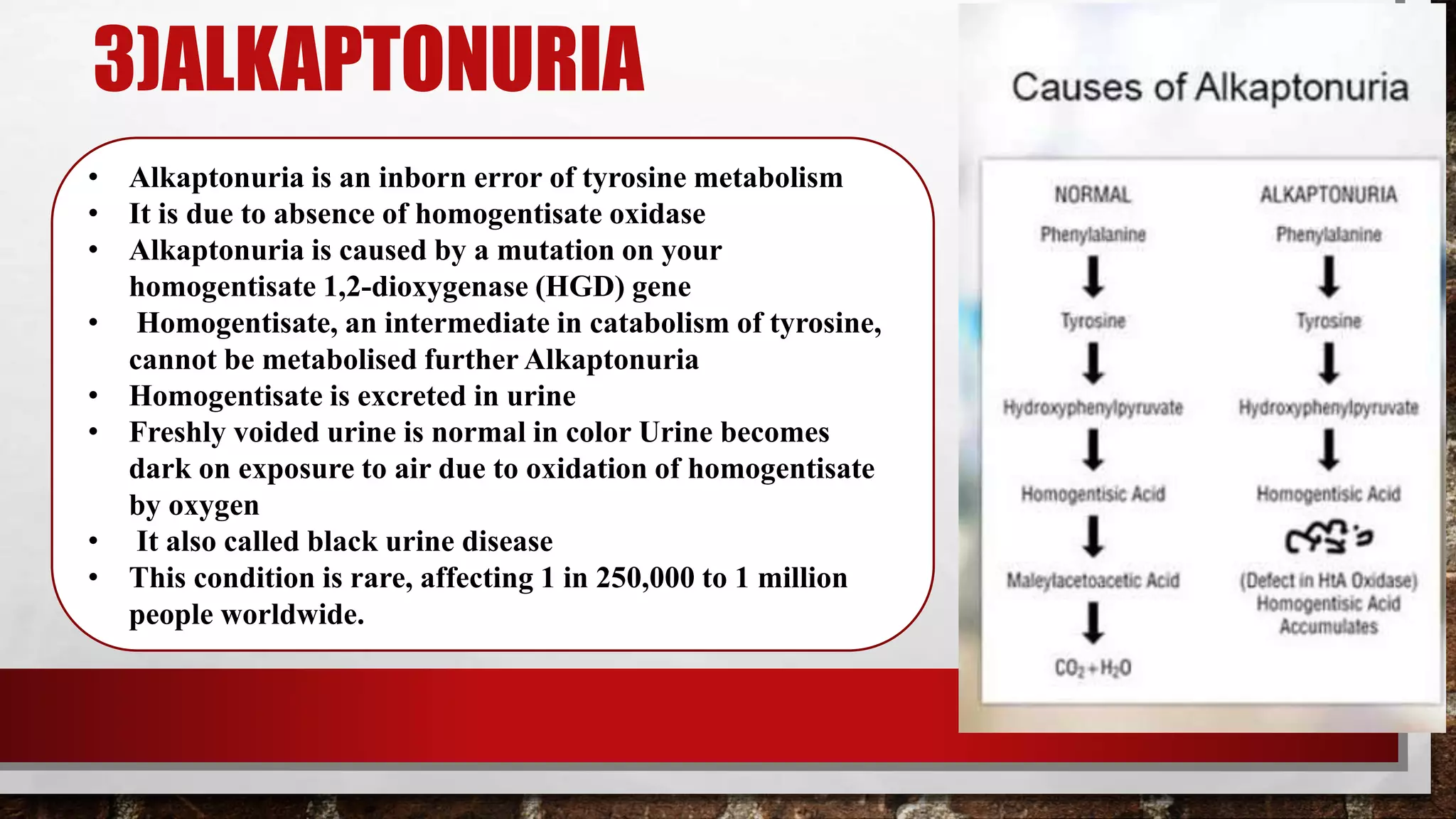 inborn errors of amino acid metabolism-phenylketonura, cystenuria ...