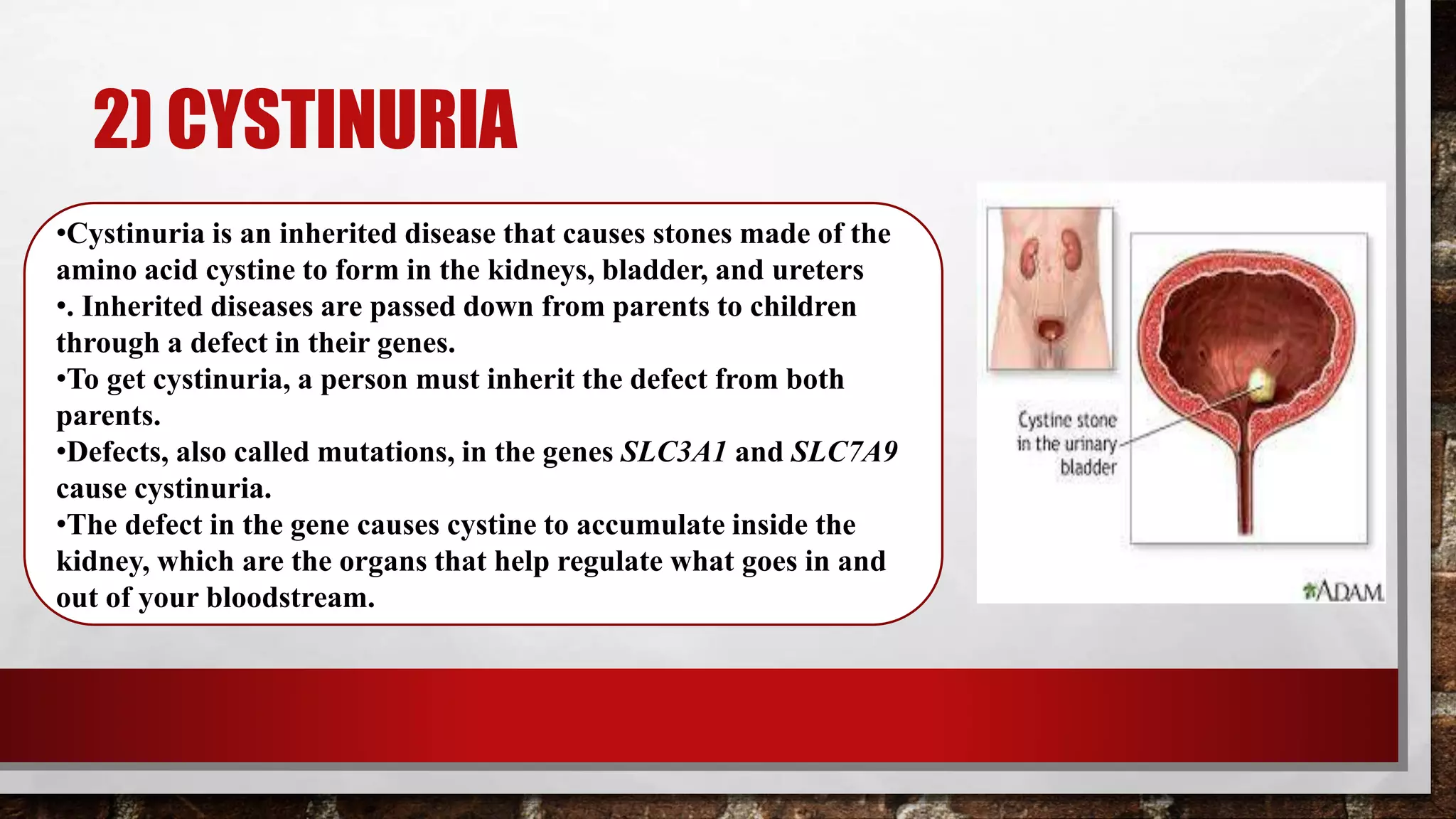 inborn errors of amino acid metabolism-phenylketonura, cystenuria ...