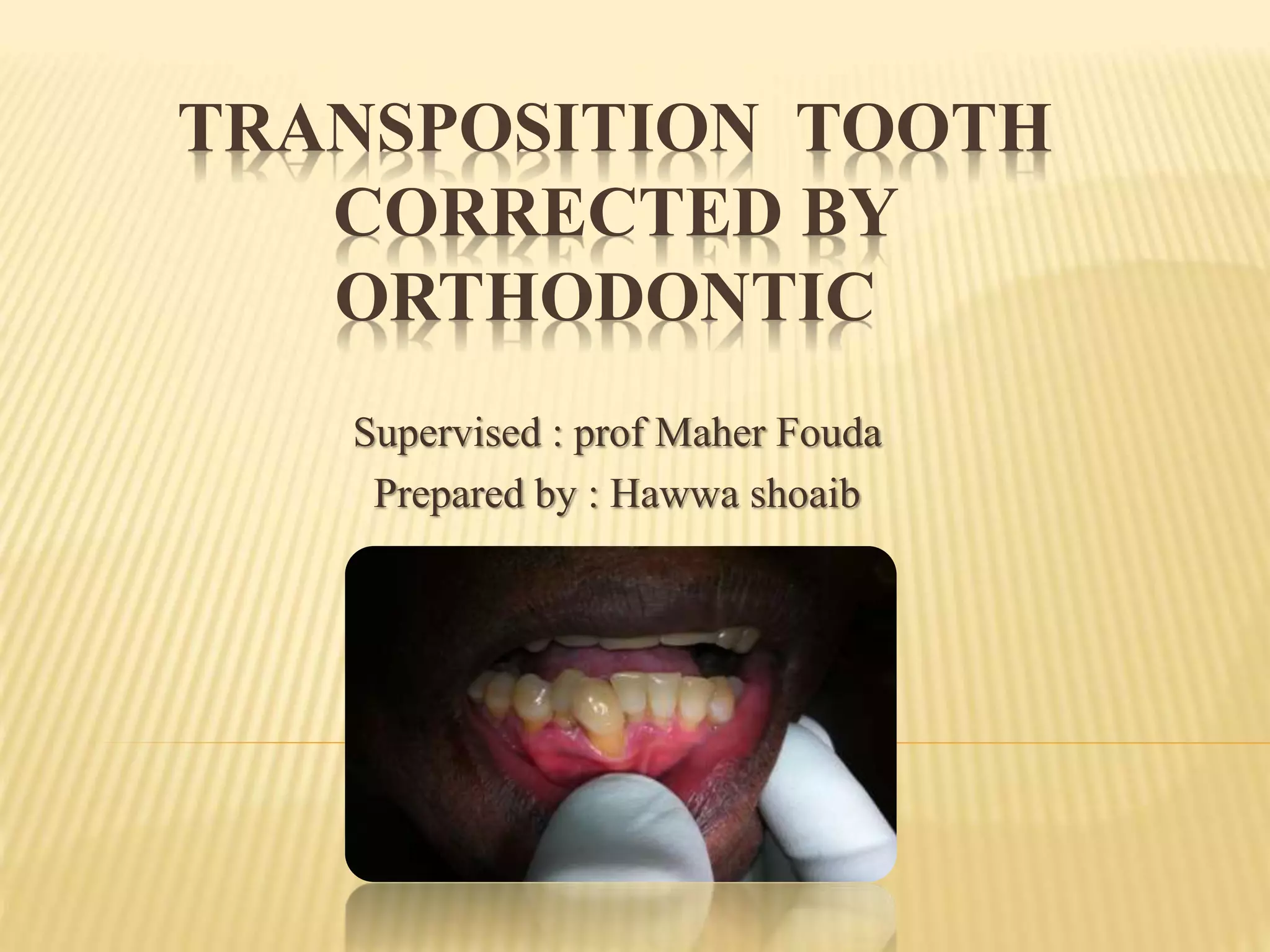 Transposition tooth corrected by orthodontic | PPTX