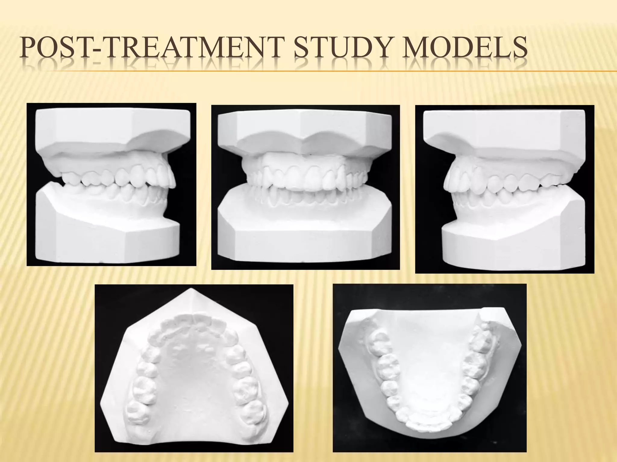 Transposition tooth corrected by orthodontic | PPTX