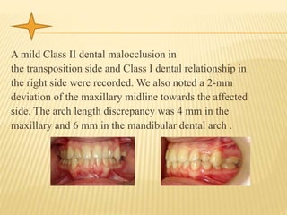 Transposition tooth corrected by orthodontic | PPTX