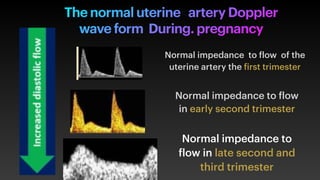 Presentation 3 uterine artery doppler .pdf