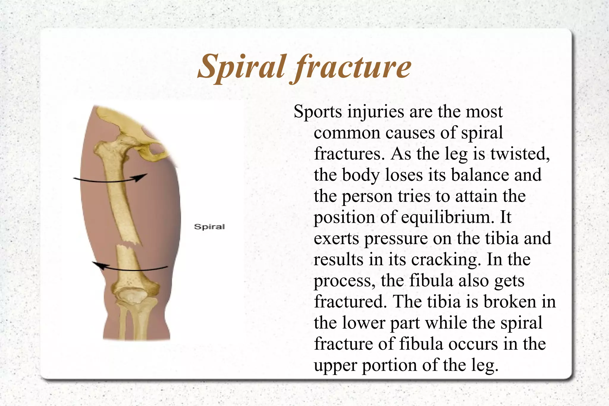 Presentation 4 | ODP