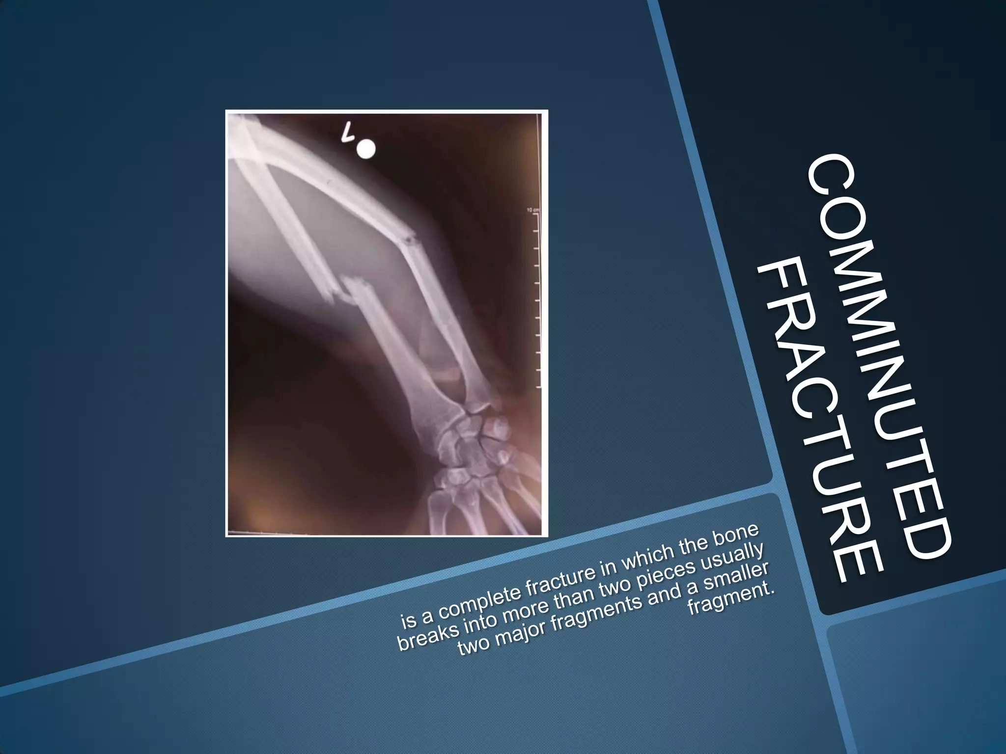 Presentation 4 | PPTX