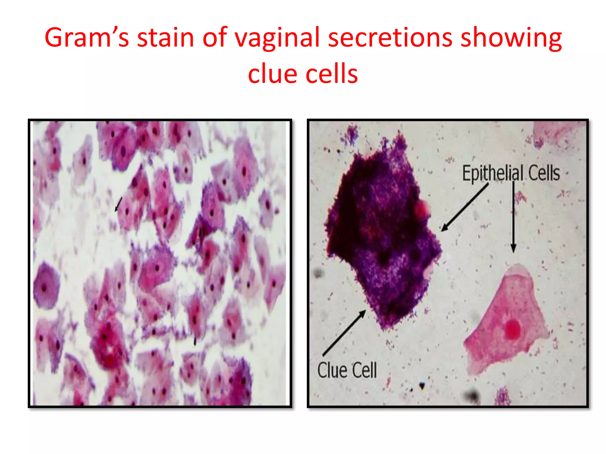 laboratory diagnosis of STI/RTI | PPTX