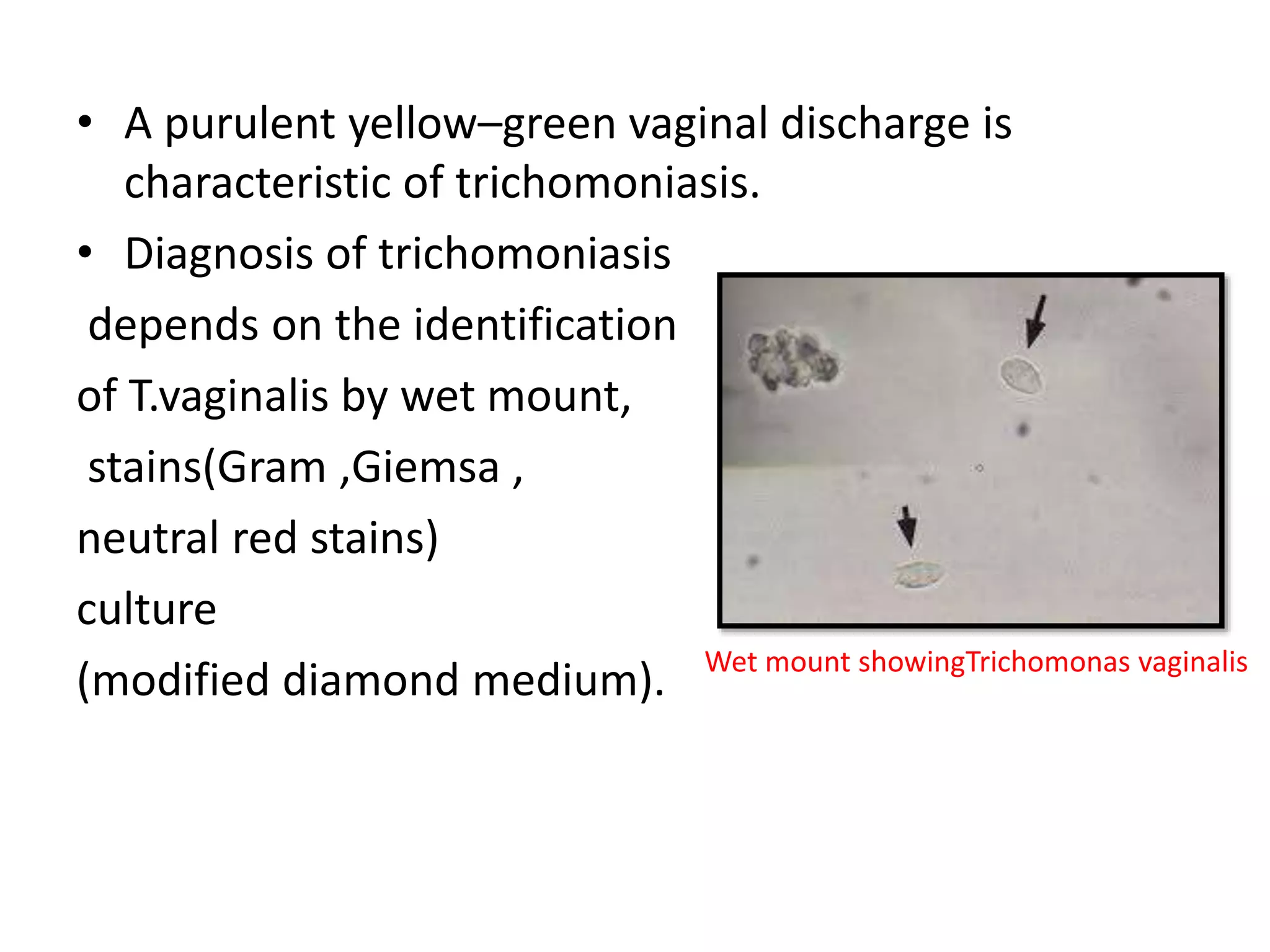 laboratory diagnosis of STI/RTI | PPTX