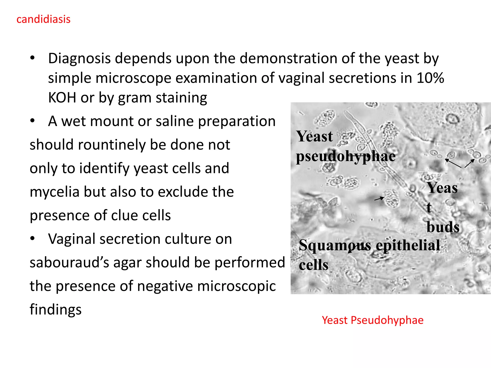 laboratory diagnosis of STI/RTI | PPTX