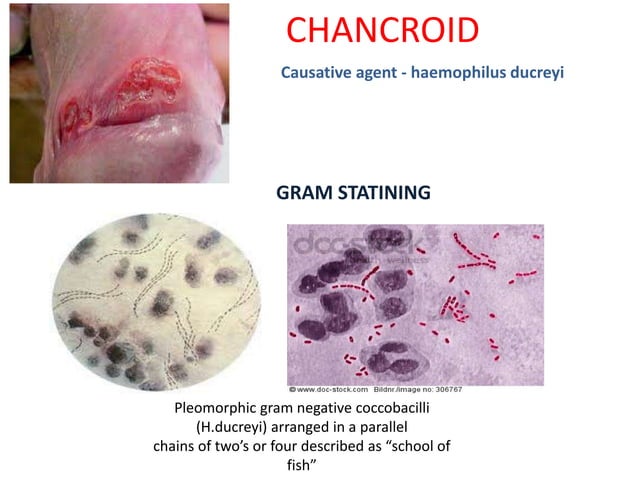 laboratory diagnosis of STI/RTI