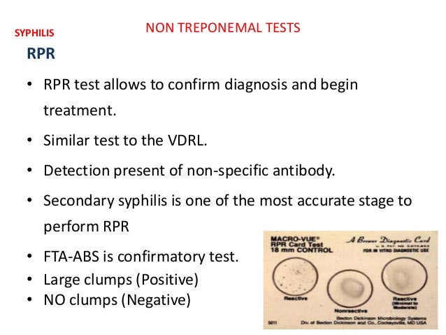 laboratory diagnosis of STI/RTI