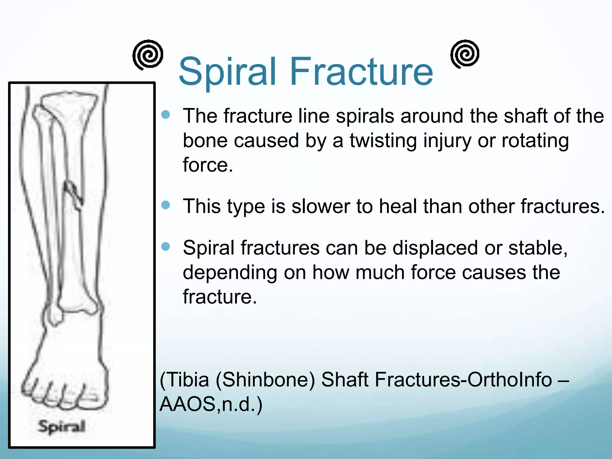 Presentation 4 | PPTX