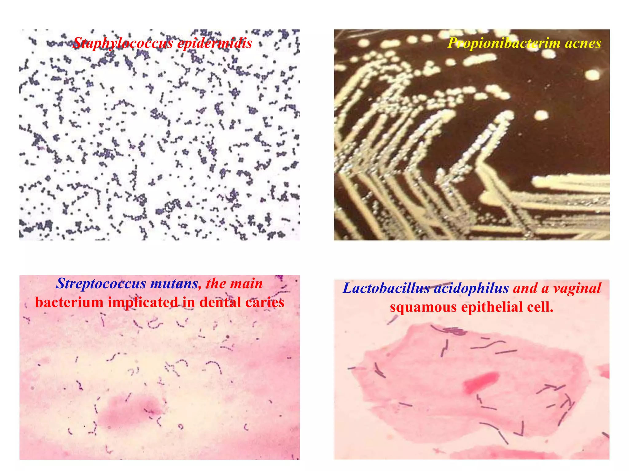 Normal Microflora of Human body | PPTX