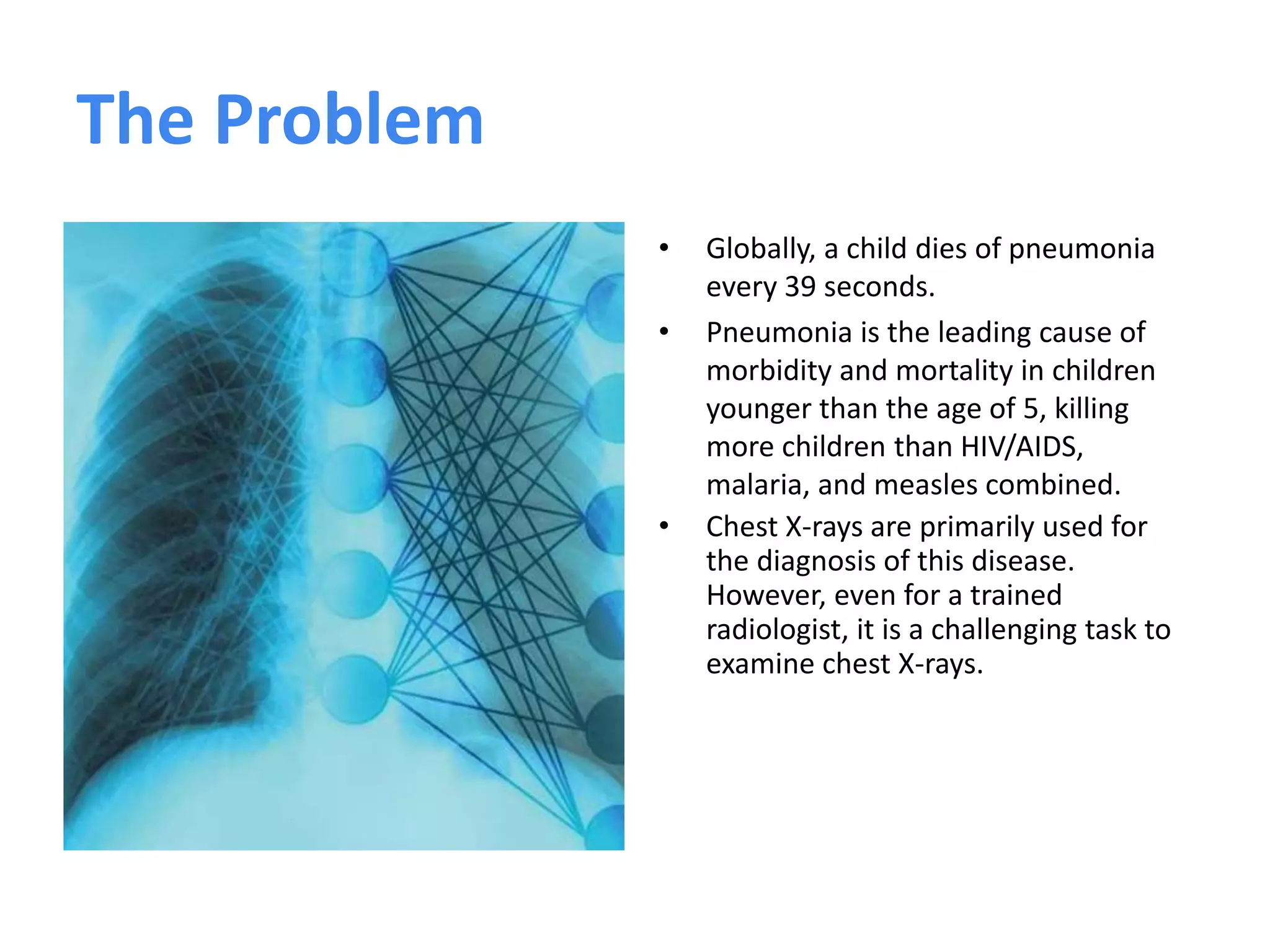 Chest X-ray Pneumonia Classification with Deep Learning | PPTX