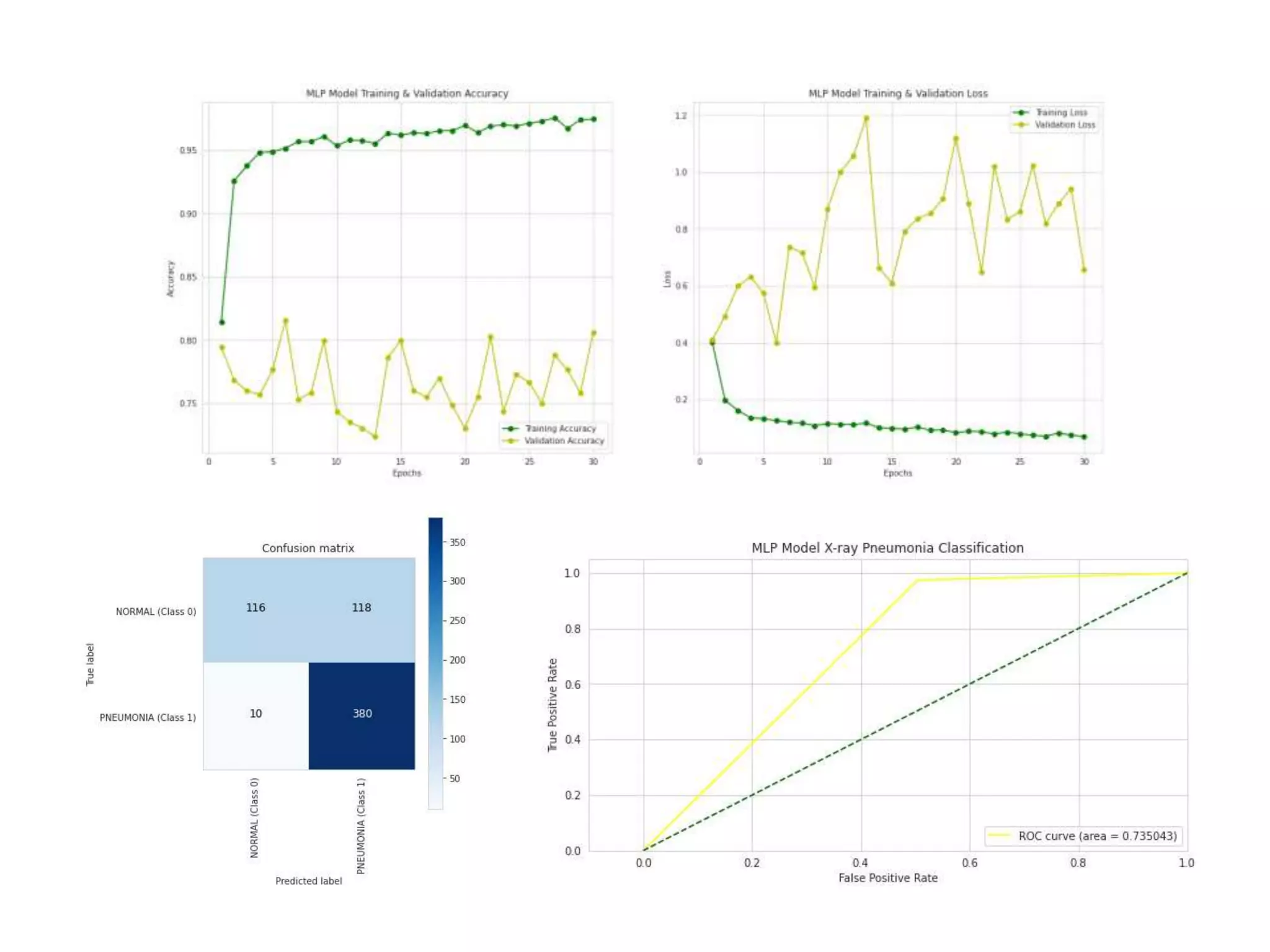 Chest X-ray Pneumonia Classification with Deep Learning | PPTX