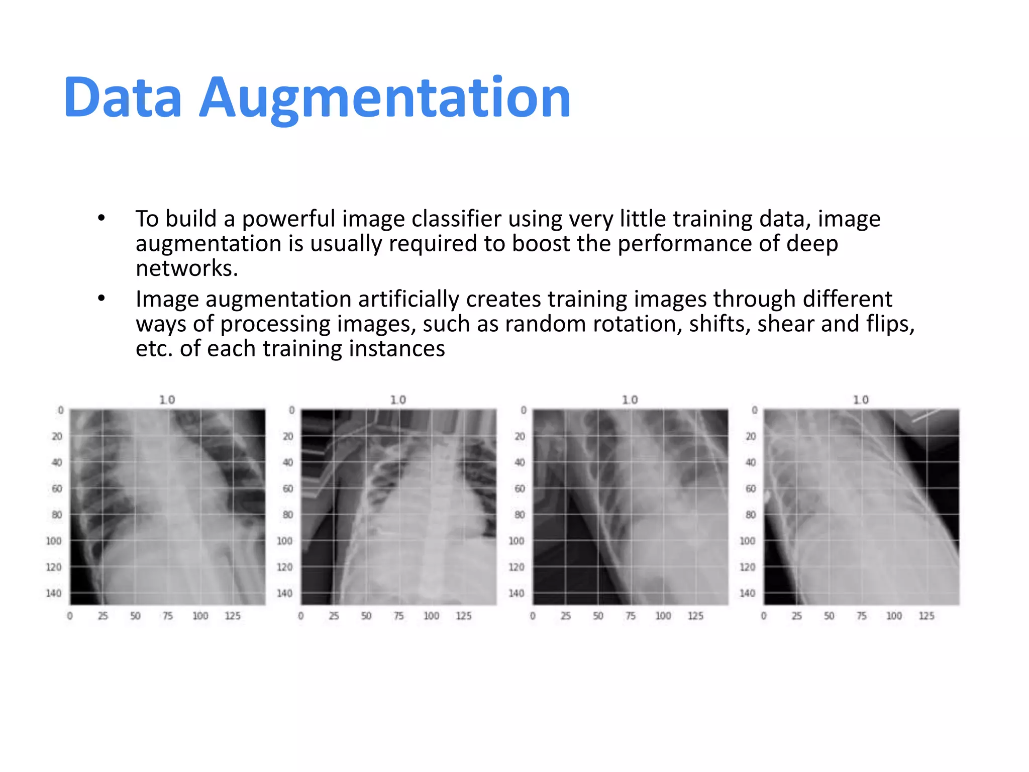 Chest X-ray Pneumonia Classification with Deep Learning | PPTX