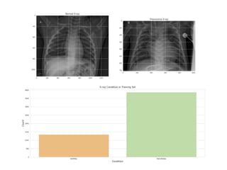 Chest X-ray Pneumonia Classification with Deep Learning | PPTX