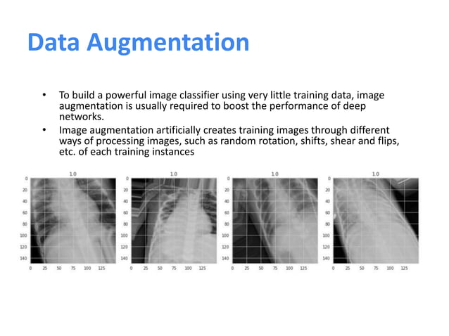 Chest X-ray Pneumonia Classification with Deep Learning | PPTX