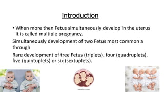 Multiple pregnancy | PPTX