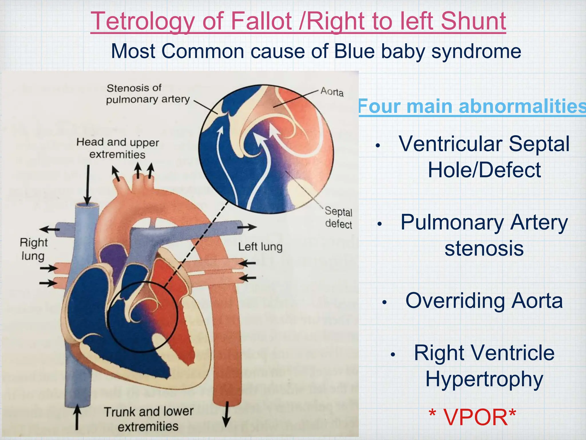 Fetal and Neonatal Circulation - MBBS, Gandhi medical College Hyderabad ...