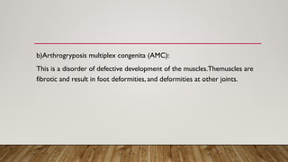 Congenital talipes equino varus Presentation (4).pptx